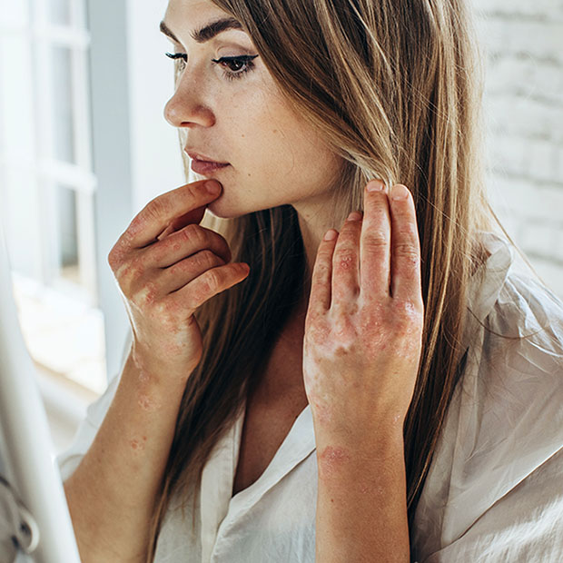 Autoimmune Conditions and Eye Health – Cary NC | Cary Eye Associates